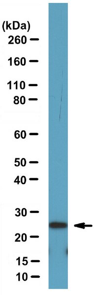 Anti-Ras-related protein Ral-A Antibody | 07-2123